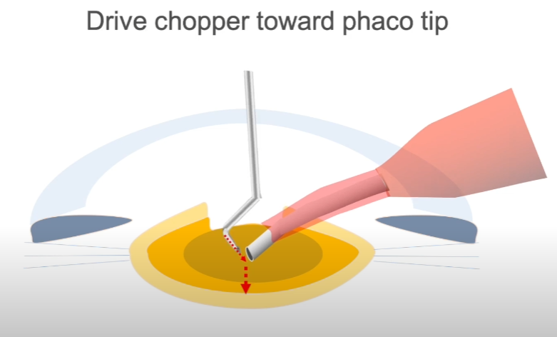 眼科医のブログ
