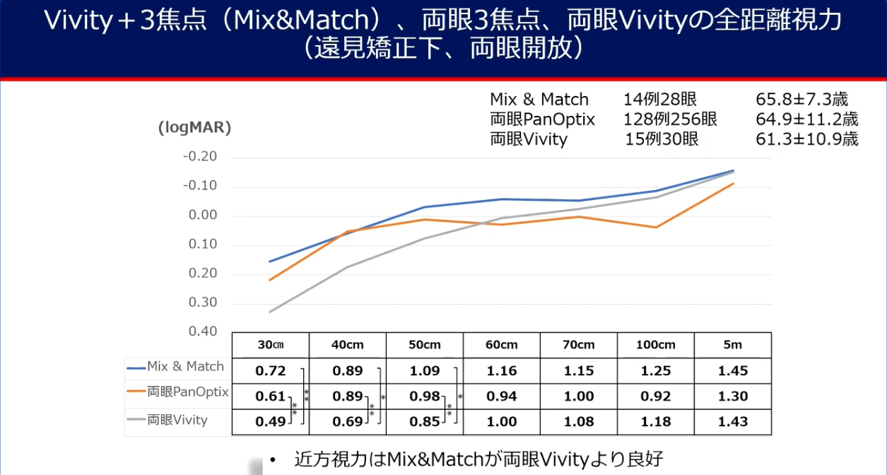 Mix＆Match法「PanOpitx,Vivity臨床データアップデート、適切なIOL選択」をみました - 眼科医のブログ